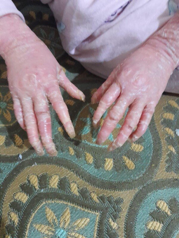 Traitement pour Boutaina - CotizUp.com